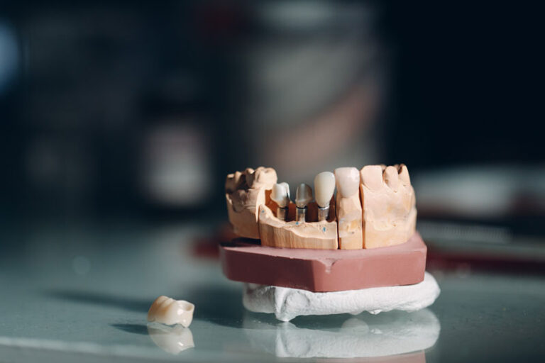Does Anything Happen If I Don’t Replace My Missing Teeth With Dental Implants? | PerioWest | Dr ...